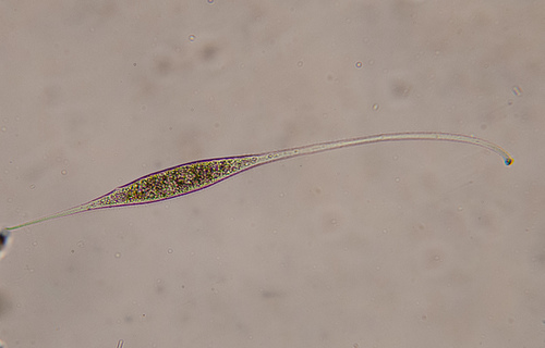 (Amphileptus procerus)