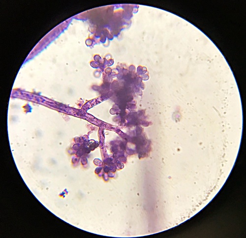 Afanomyces (Aphanomyces)