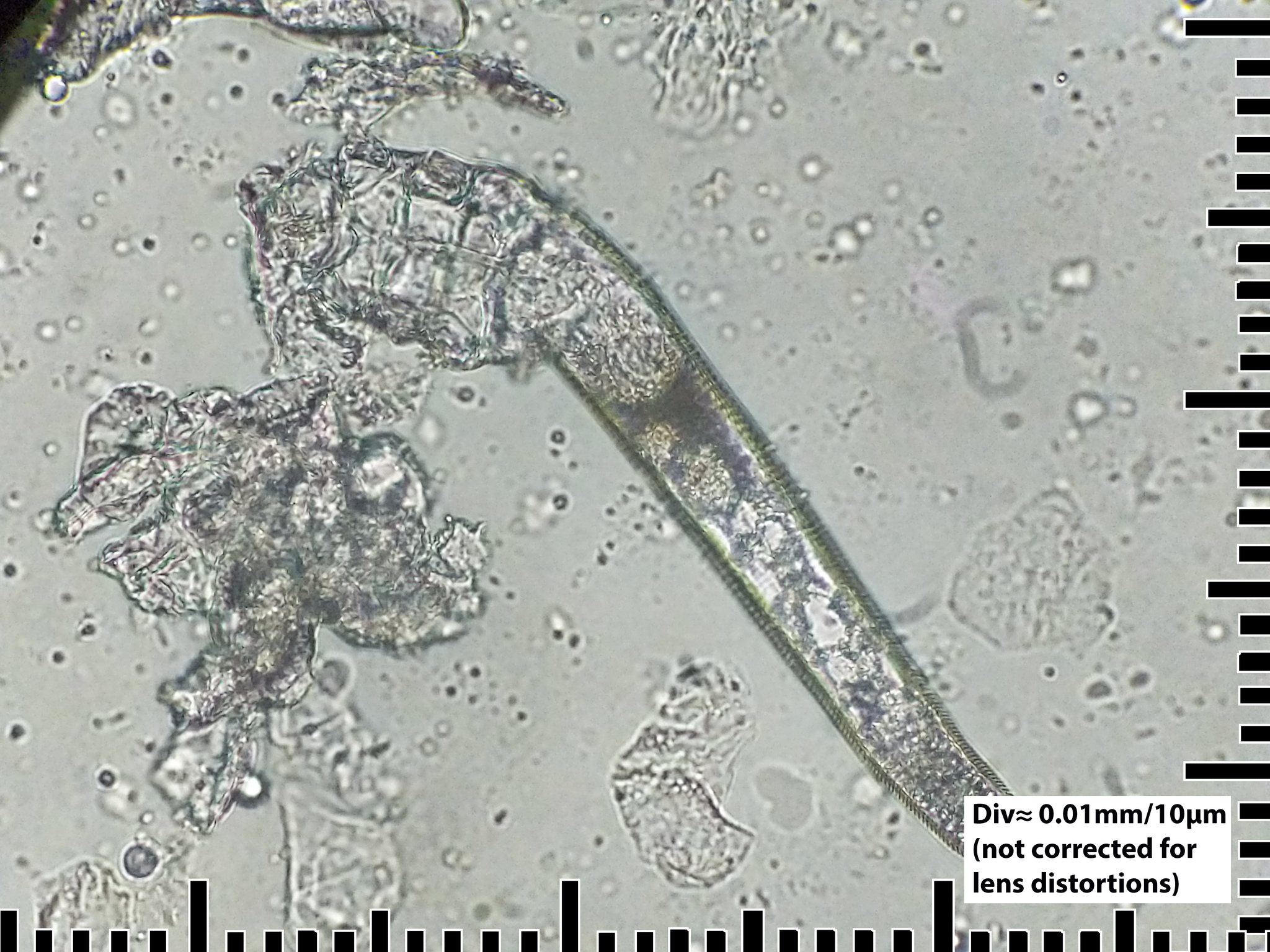 Demodex folliculorum (Simon, 1842)
