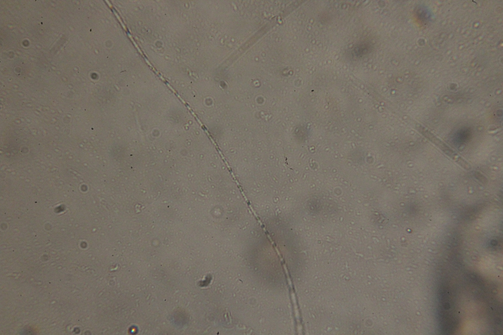 Limnothrix redekei (Goor) M.-E.Meffert