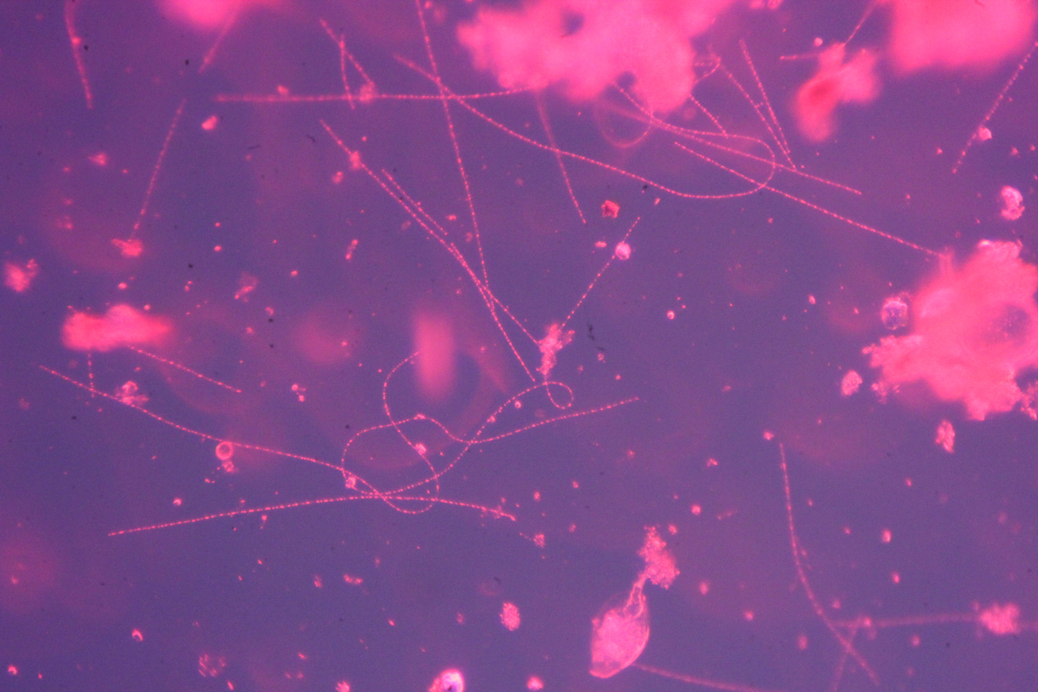 Limnothrix redekei (Goor) M.-E.Meffert