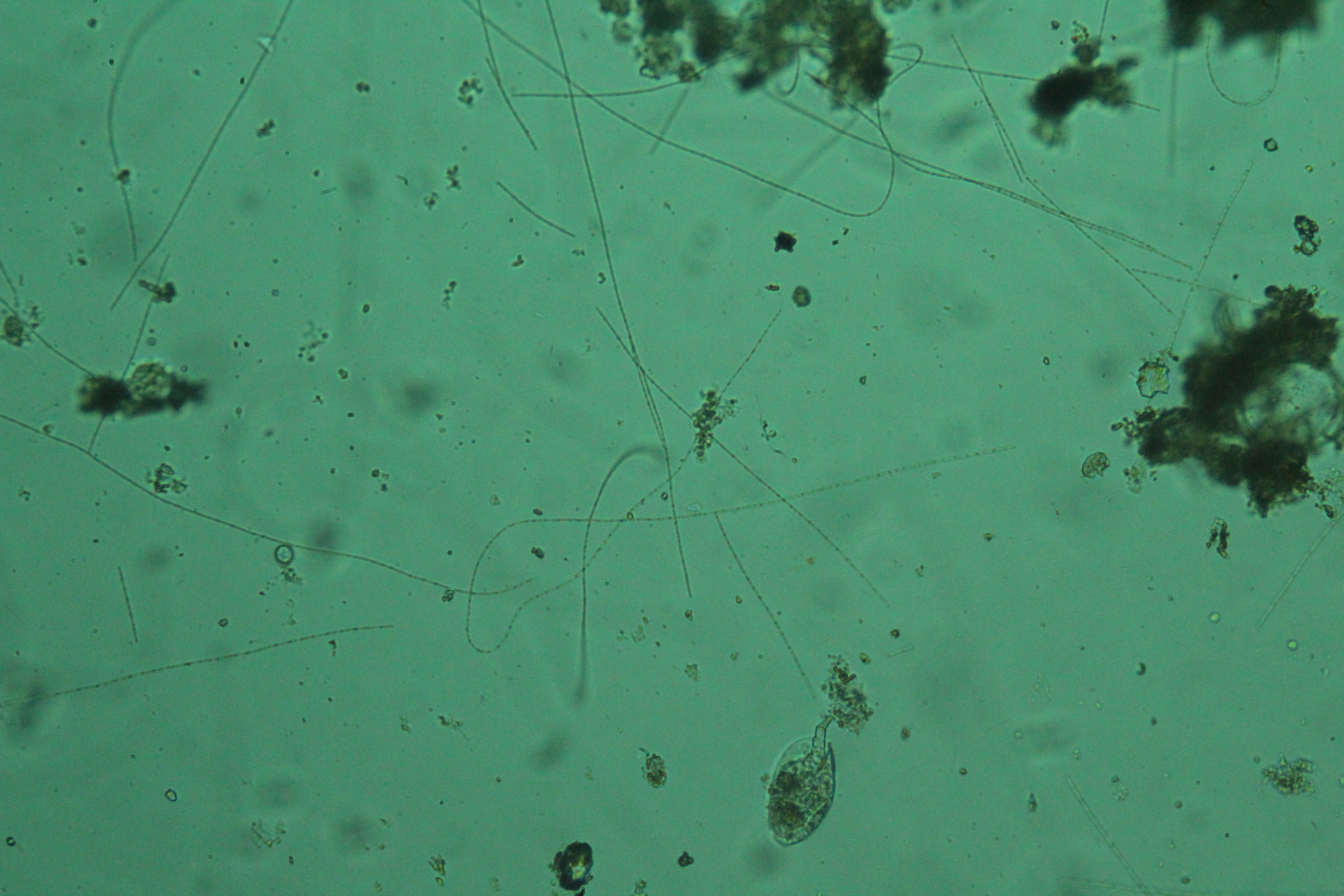 Limnothrix redekei (Goor) M.-E.Meffert