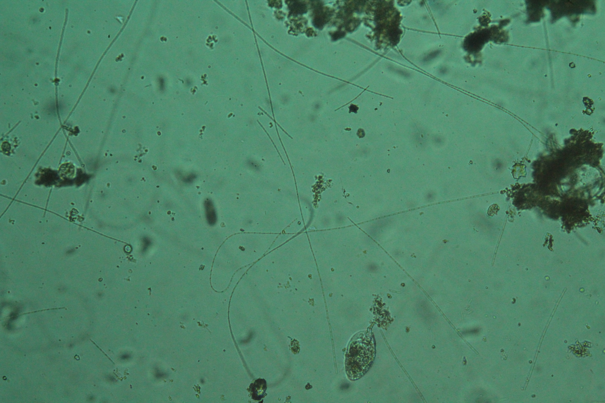 Limnothrix redekei (Goor) M.-E.Meffert