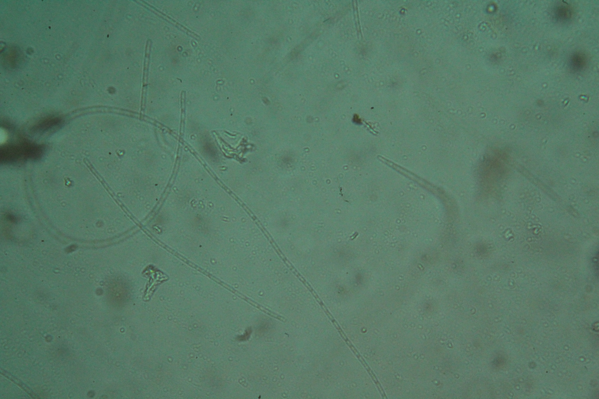 Limnothrix redekei (Goor) M.-E.Meffert