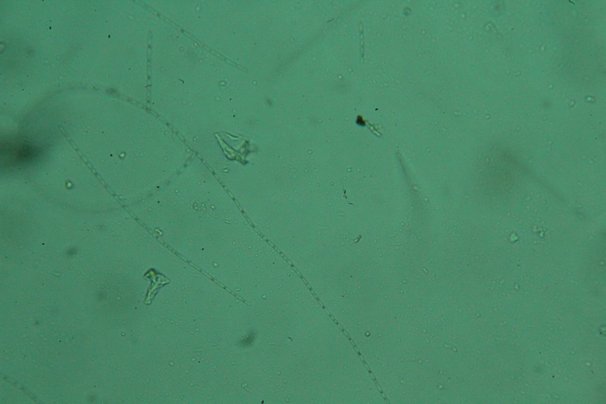 Limnothrix redekei (Goor) M.-E.Meffert