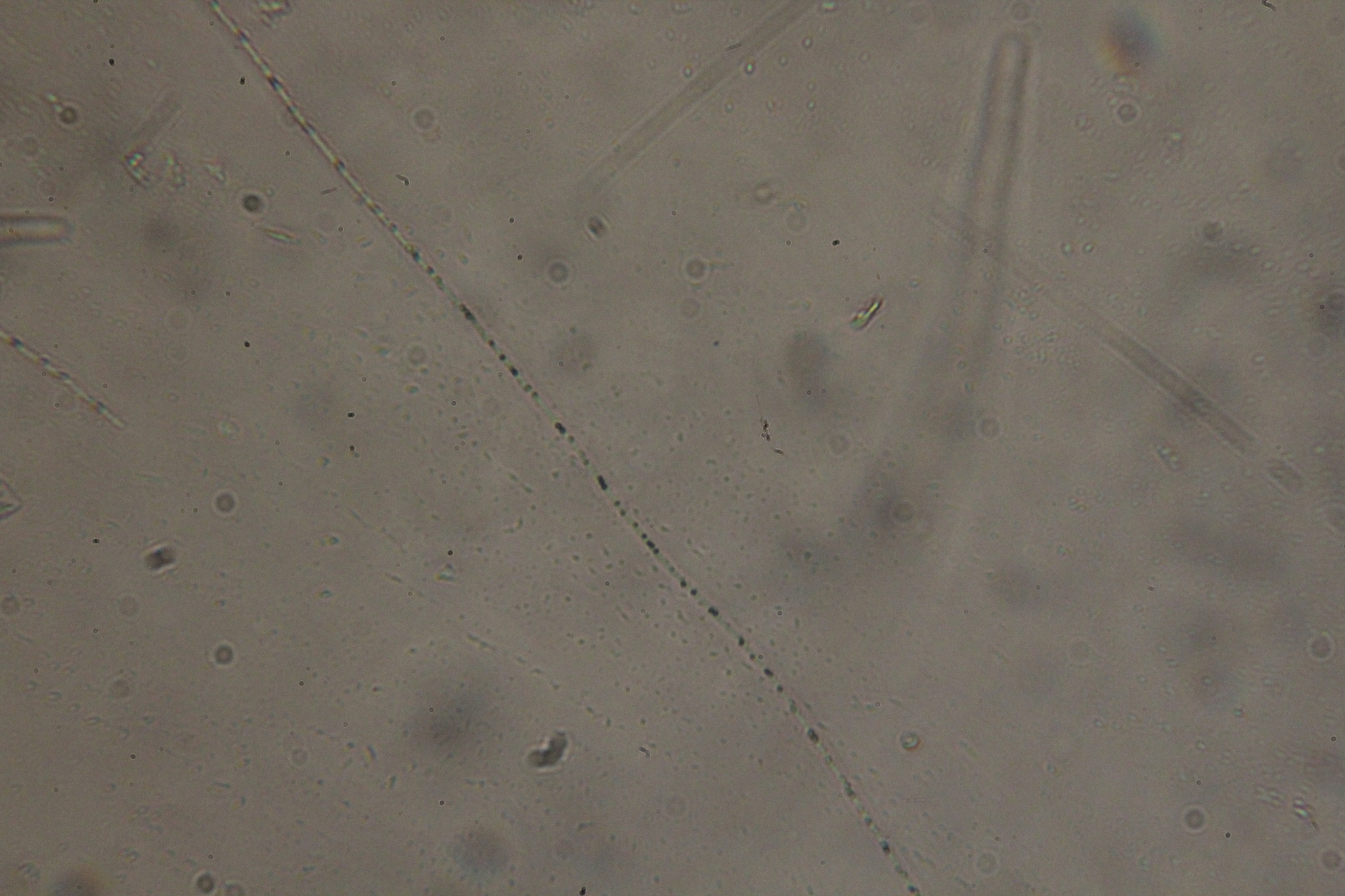 Limnothrix redekei (Goor) M.-E.Meffert