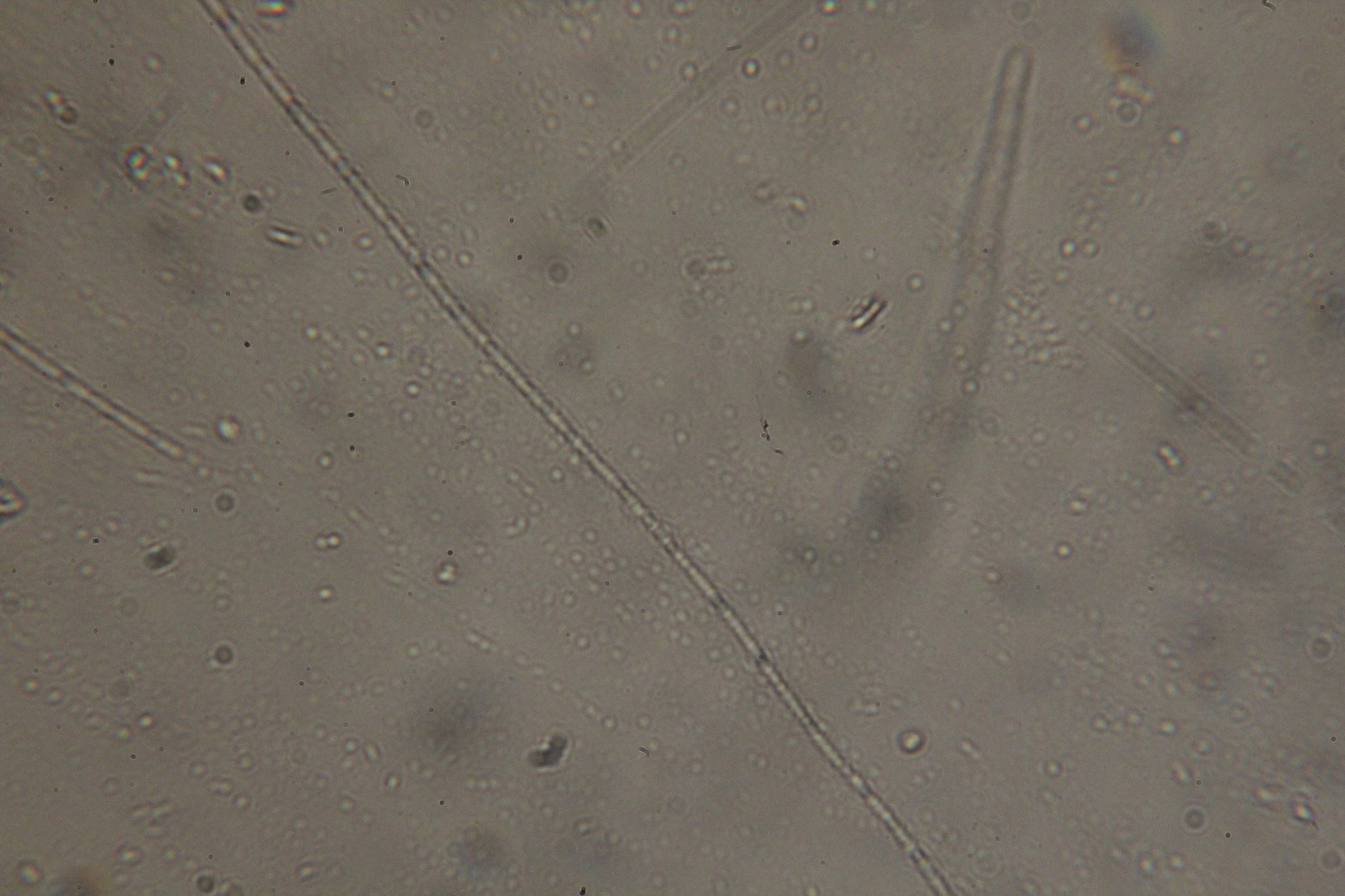 Limnothrix redekei (Goor) M.-E.Meffert