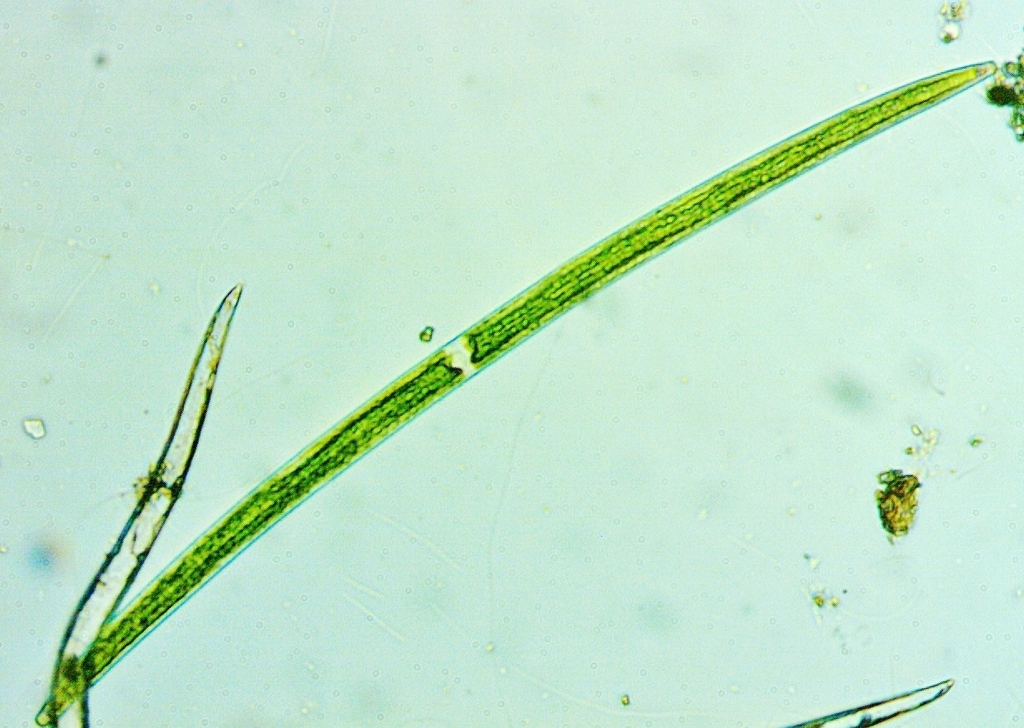(Closterium lineatum) - Botanical Realm