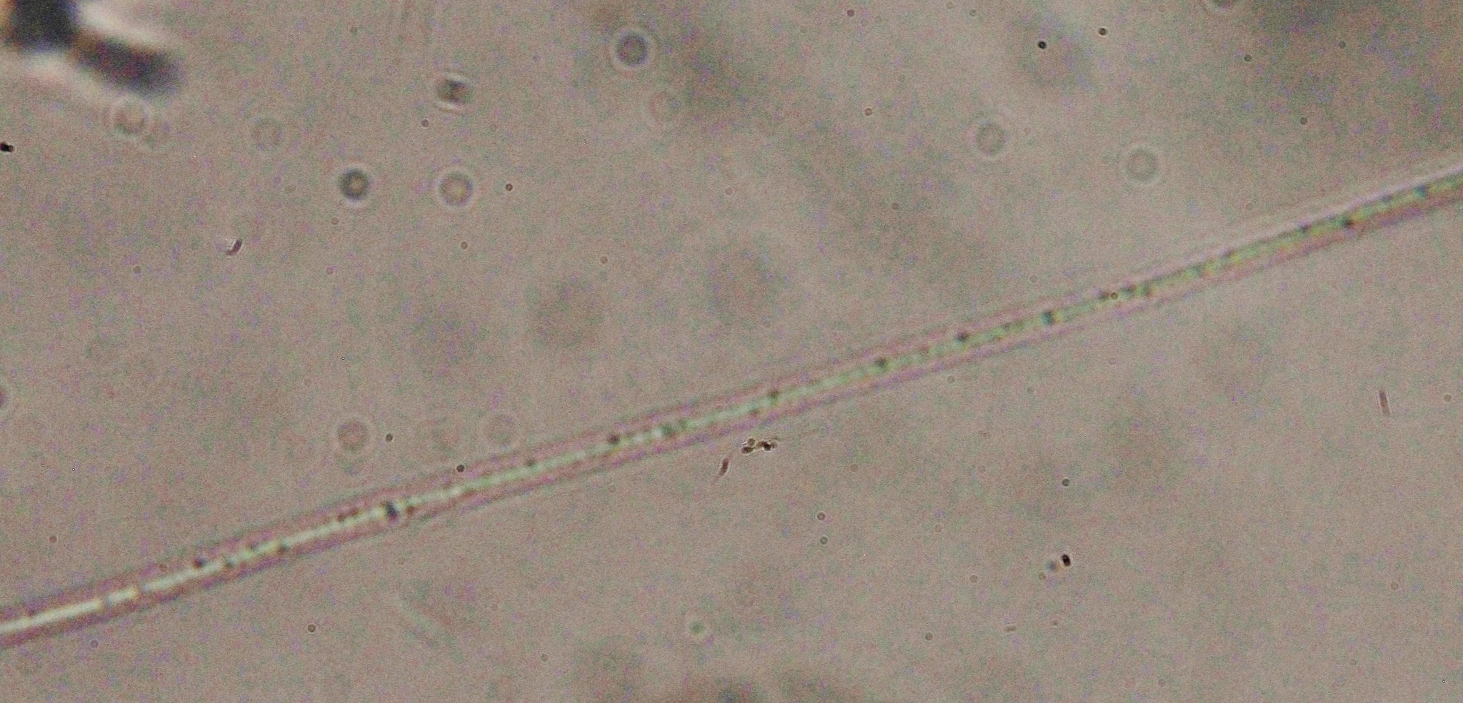 Limnothrix redekei (Goor) M.-E.Meffert