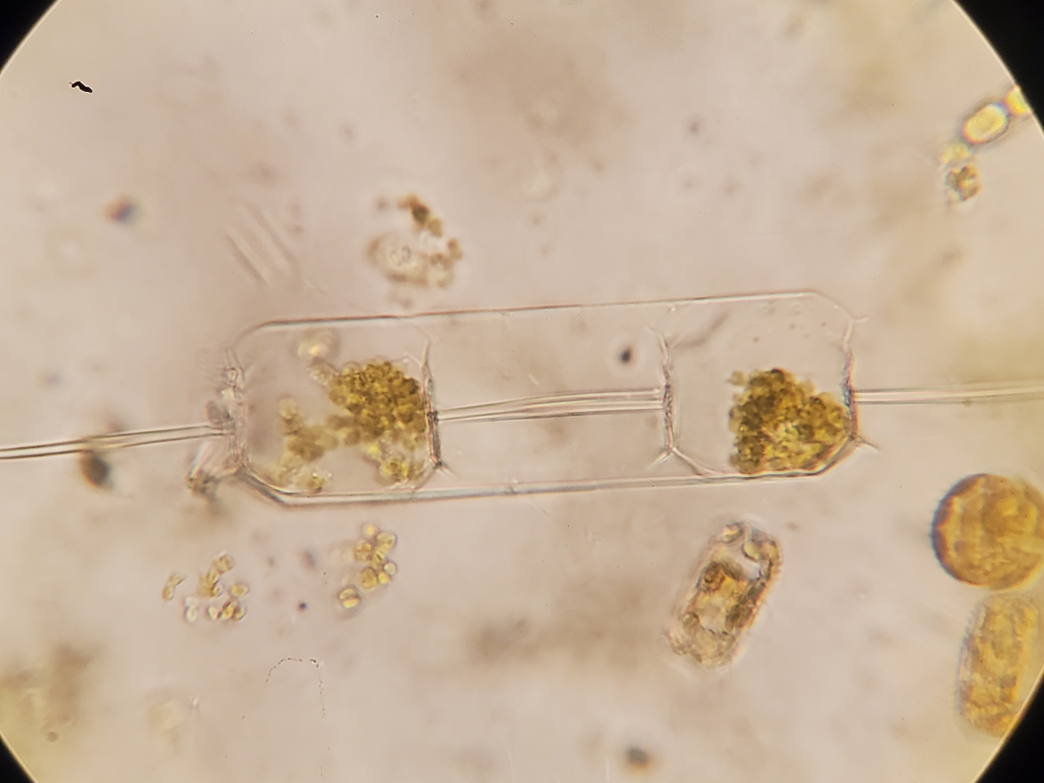 Ditylum brightwellii (T.West) Grunow, 1885