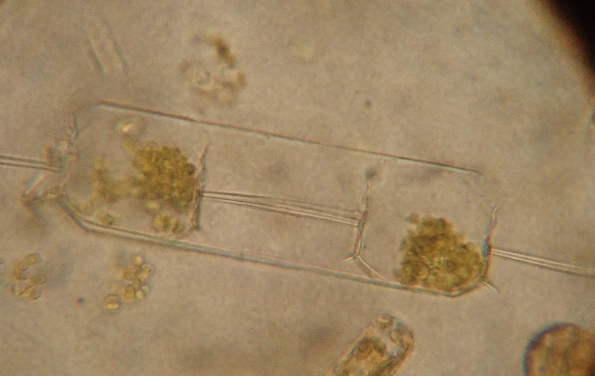 Ditylum brightwellii (T.West) Grunow, 1885