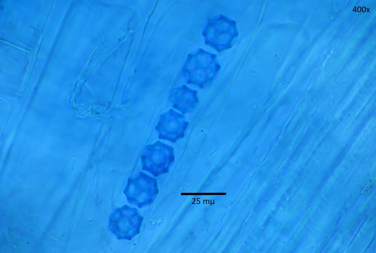 Olpidium (A.Braun) J.Schröt., 1886
