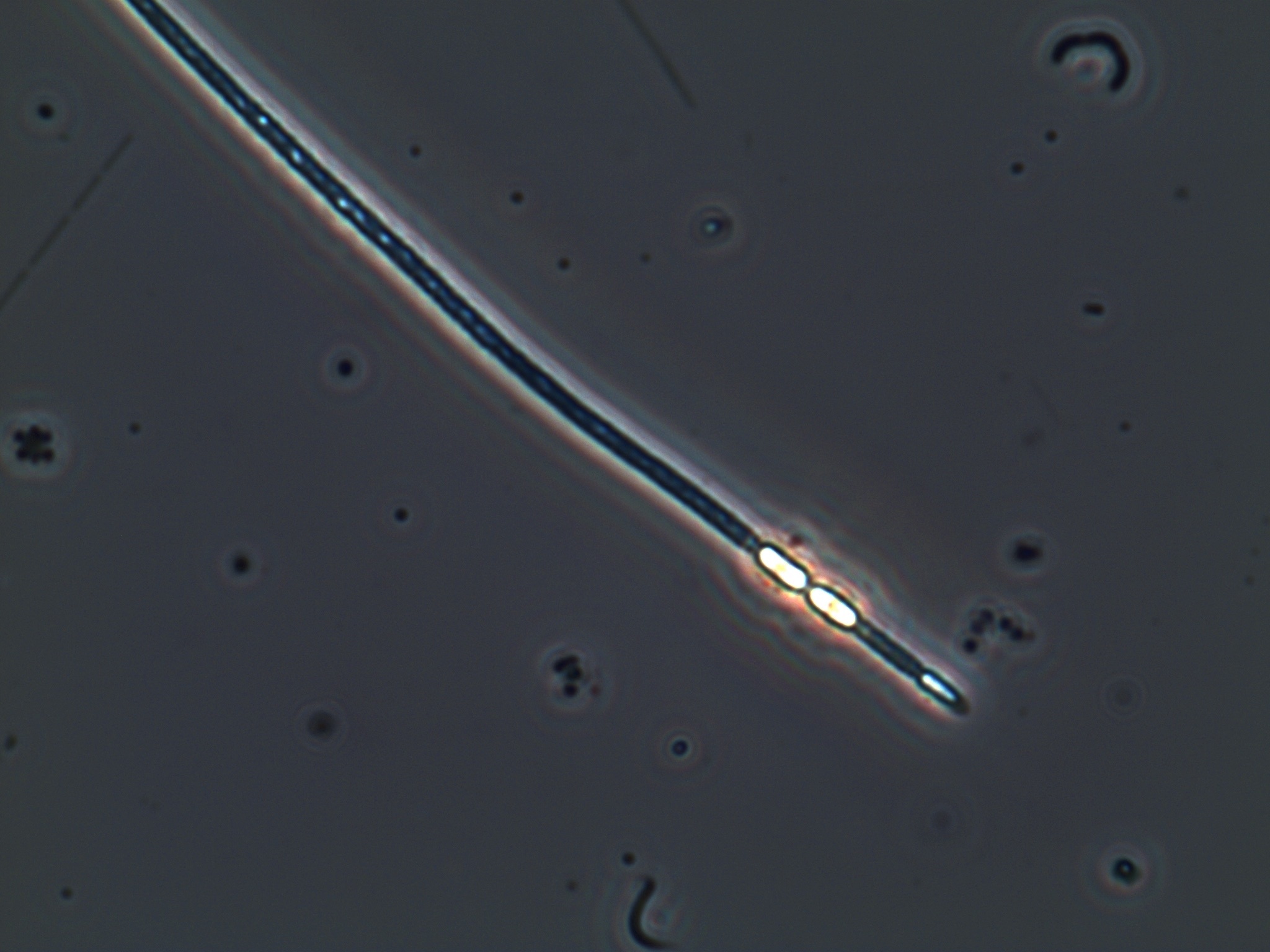 Cylindrospermopsis G.Seenayya & N.Subba Raju, 1972