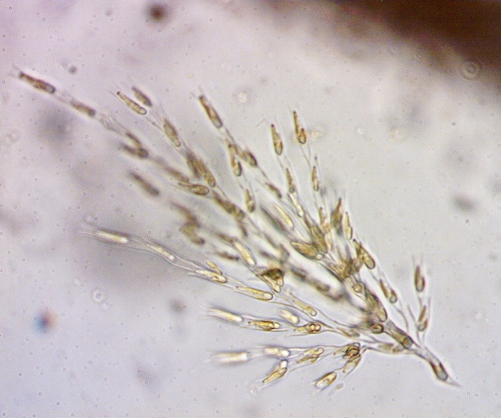 Dinobryon Chrysophyta