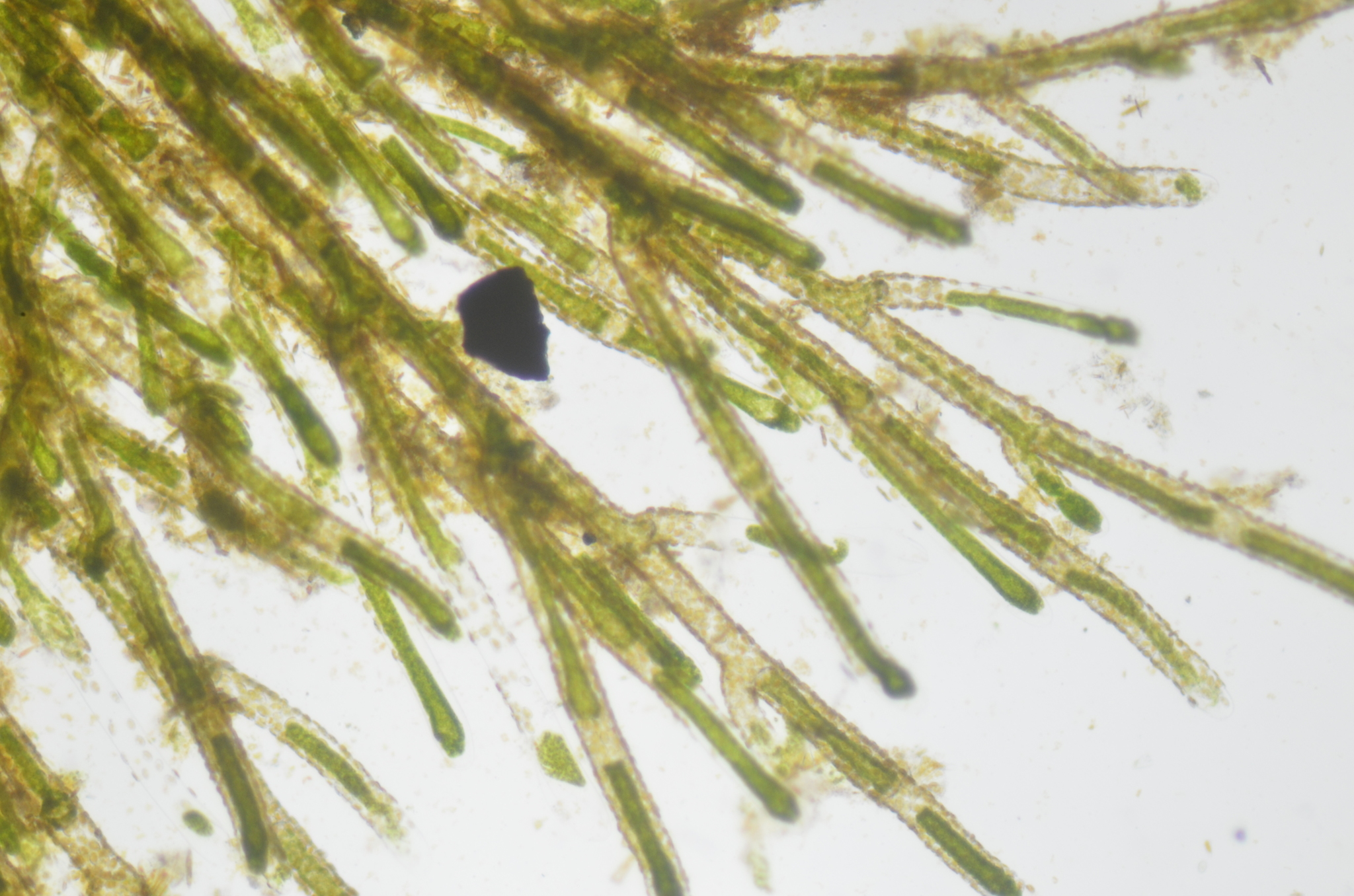 Cladophora Microscope Labelled