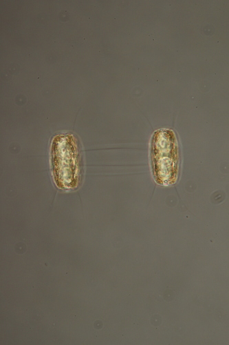 Thalassiosira angustelineata · iNaturalist United Kingdom