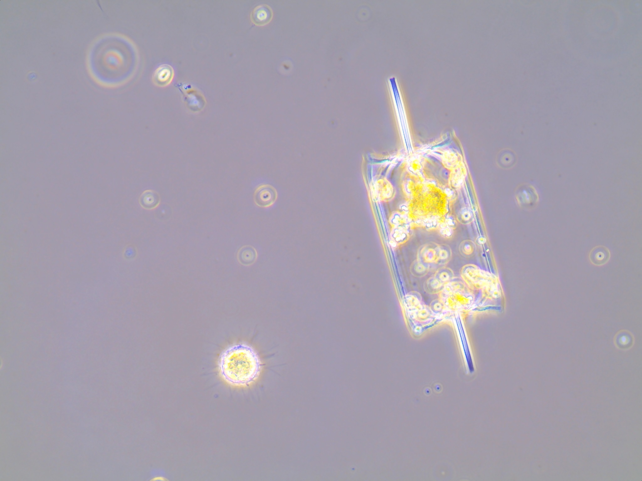 Ditylum brightwellii (T.West) Grunow, 1885