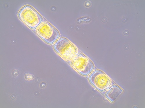 Stephanopyxis turris · iNaturalist