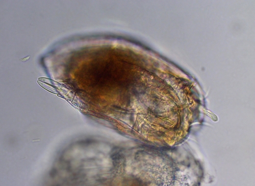 Género Ploesoma · iNaturalist Mexico