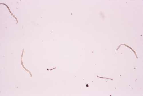 Onchocerciasis (Onchocerca volvulus) · iNaturalist
