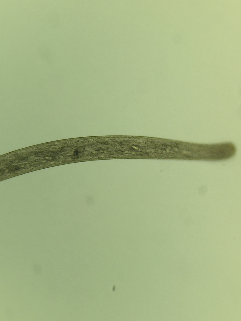 Loxodes (ACC common pond water sample organisms) · iNaturalist