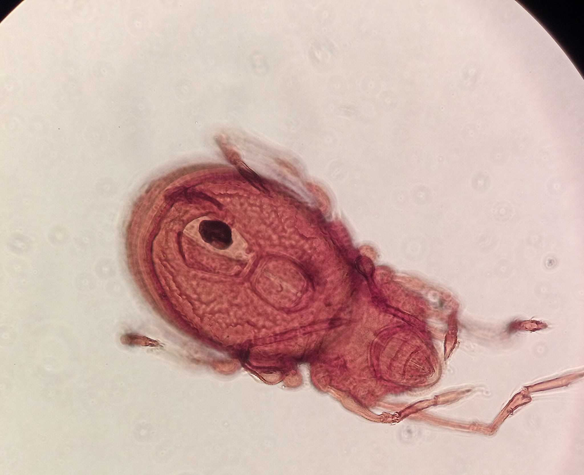 Hymenolepis Nana Cisticercoide