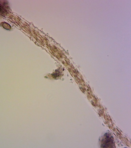 Genus Berkeleya · iNaturalist