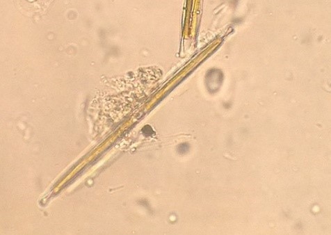 Ulnaria acus · iNaturalist