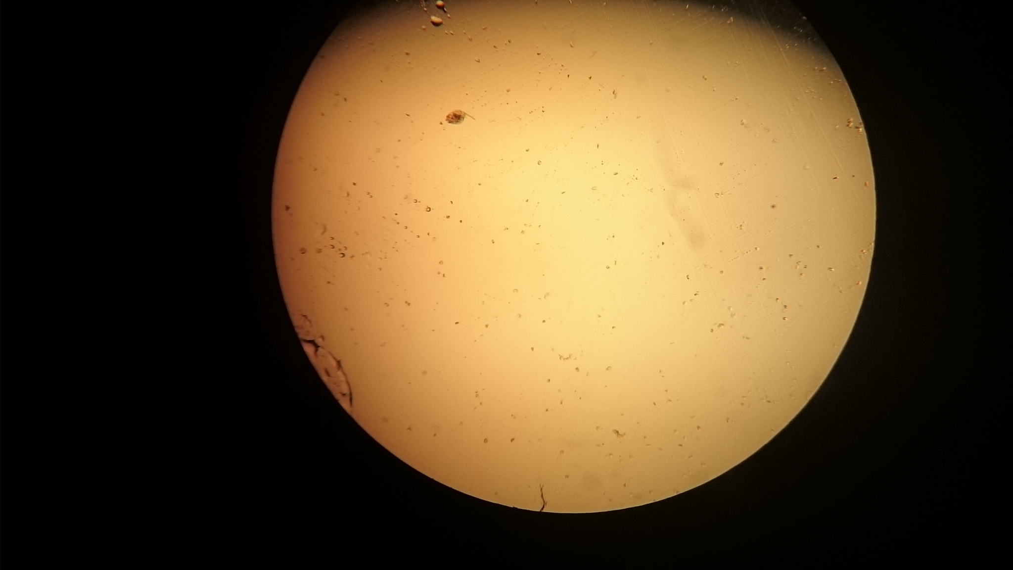 Lecane quadridentata (Ehrenberg, 1830)