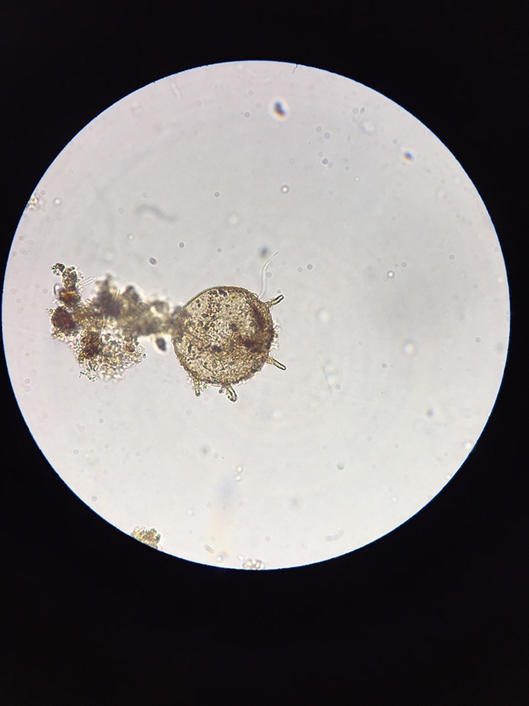 Centropyxis aculeata (Ehrenberg, 1832) Stein, 1859