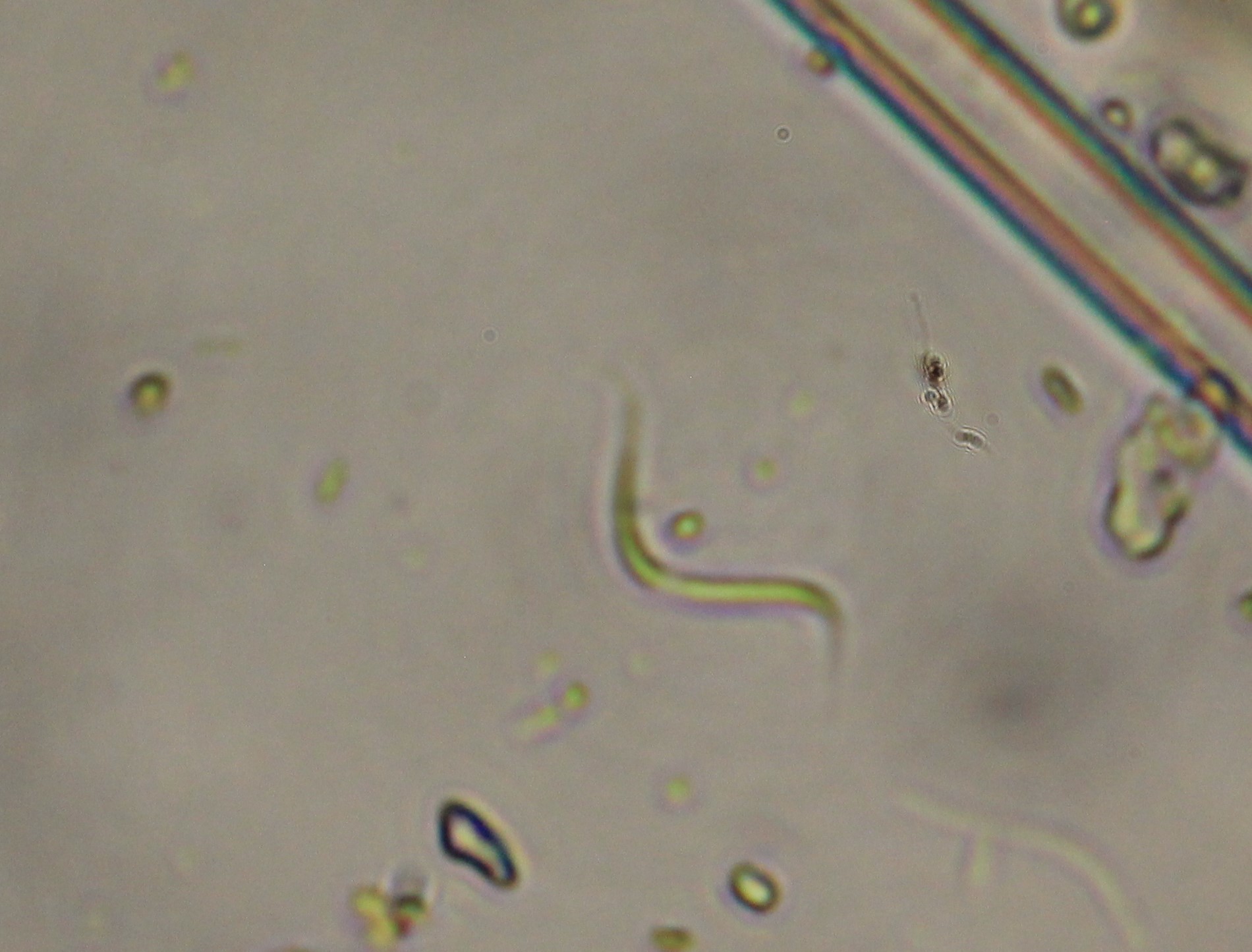 Monoraphidium Komárková-Legnerová, 1969