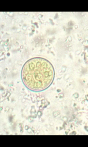 Morfologia Da Entamoeba Coli
