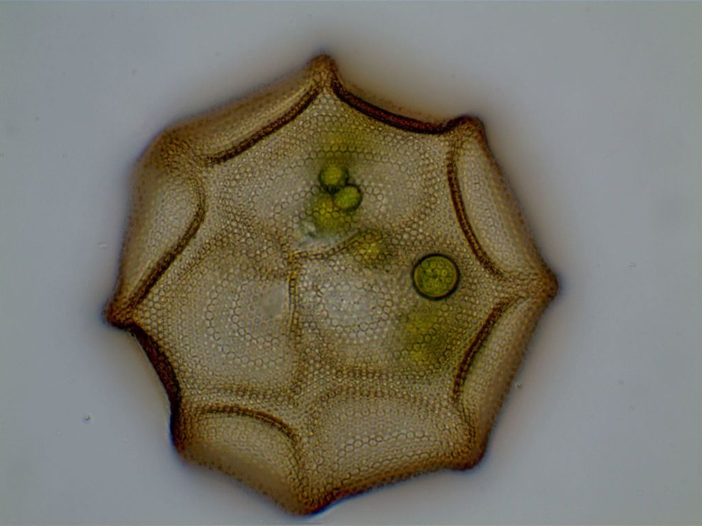 Arcella conica from Ridge Rd, Ottawa, ON K0A 2Y0, Canada on September ...