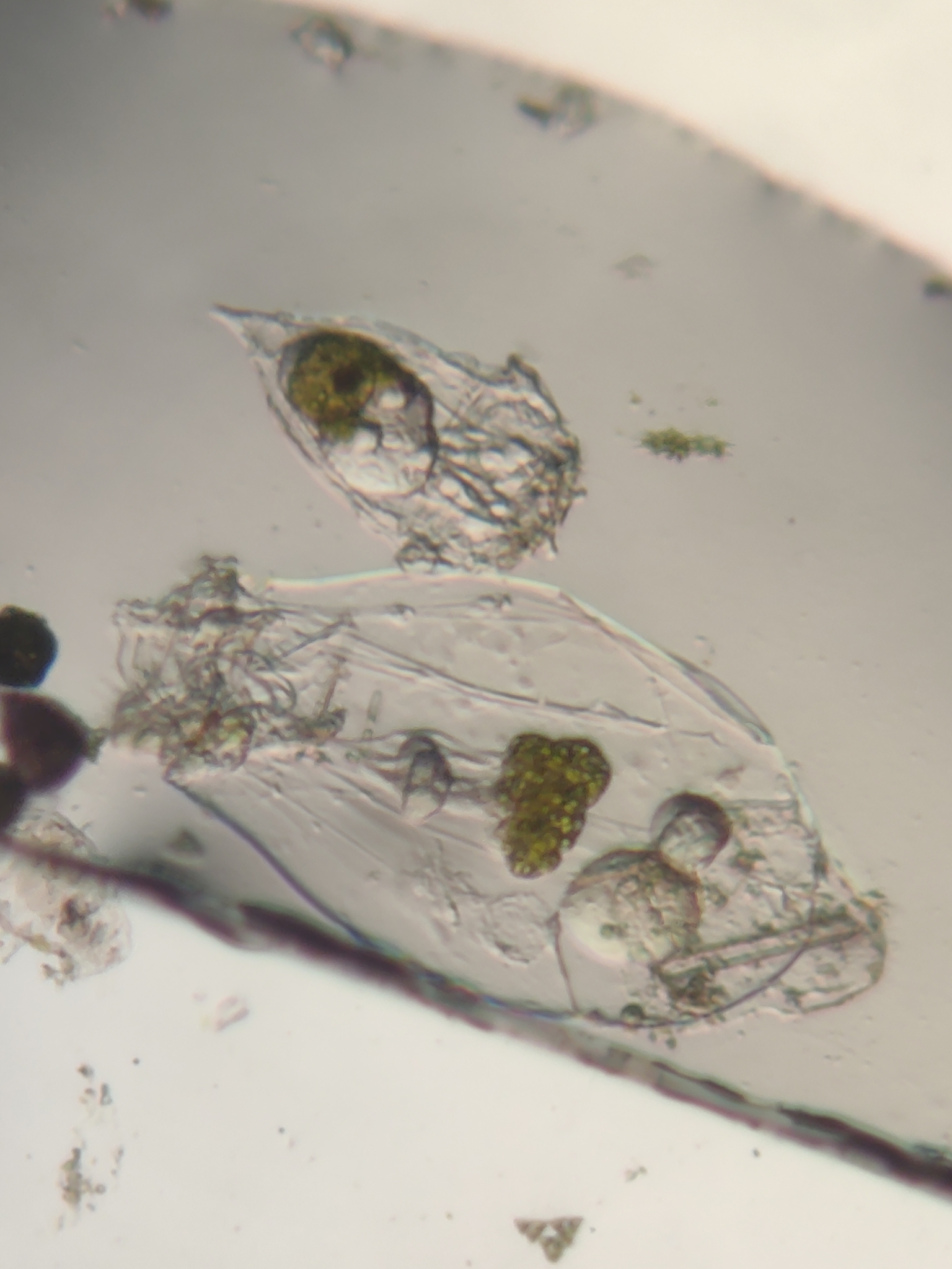 Synchaeta pectinata Ehrenberg, 1832