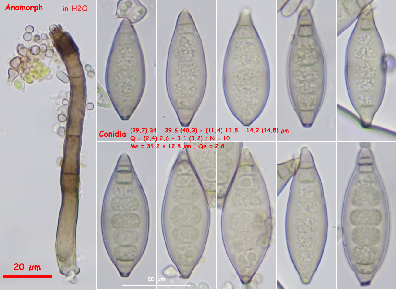 Strossmayeria basitricha (Sacc.) Dennis