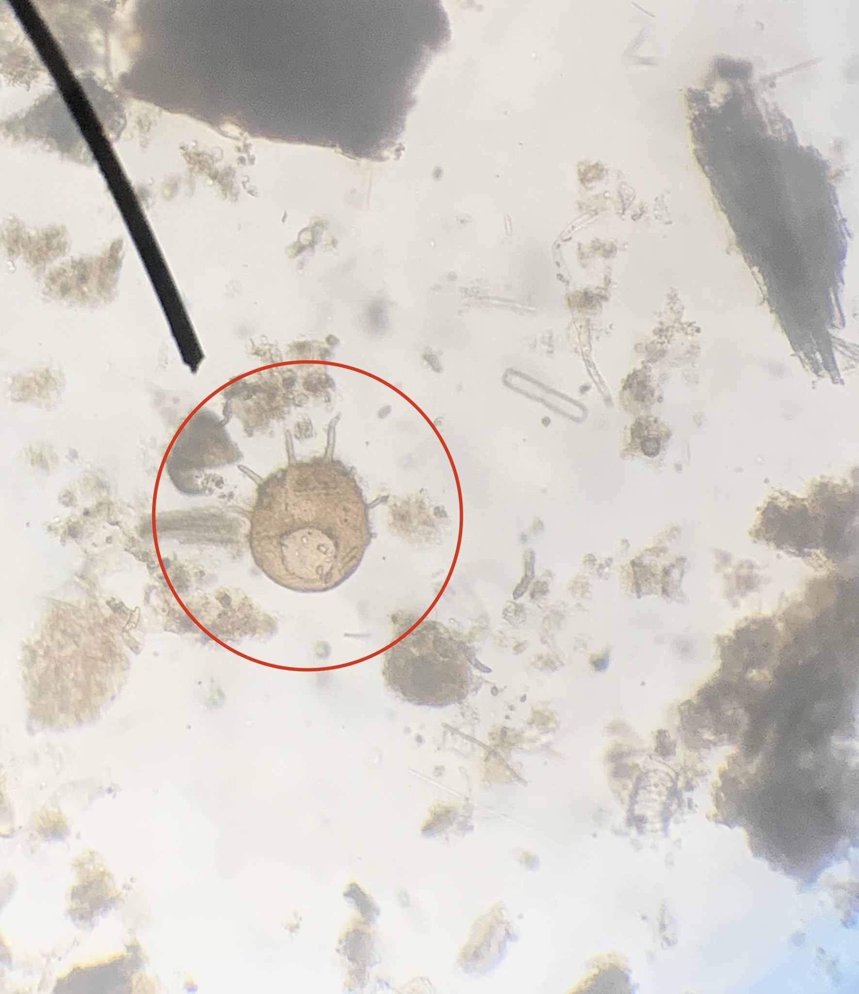 Centropyxis aculeata (Ehrenberg, 1832) Stein, 1859