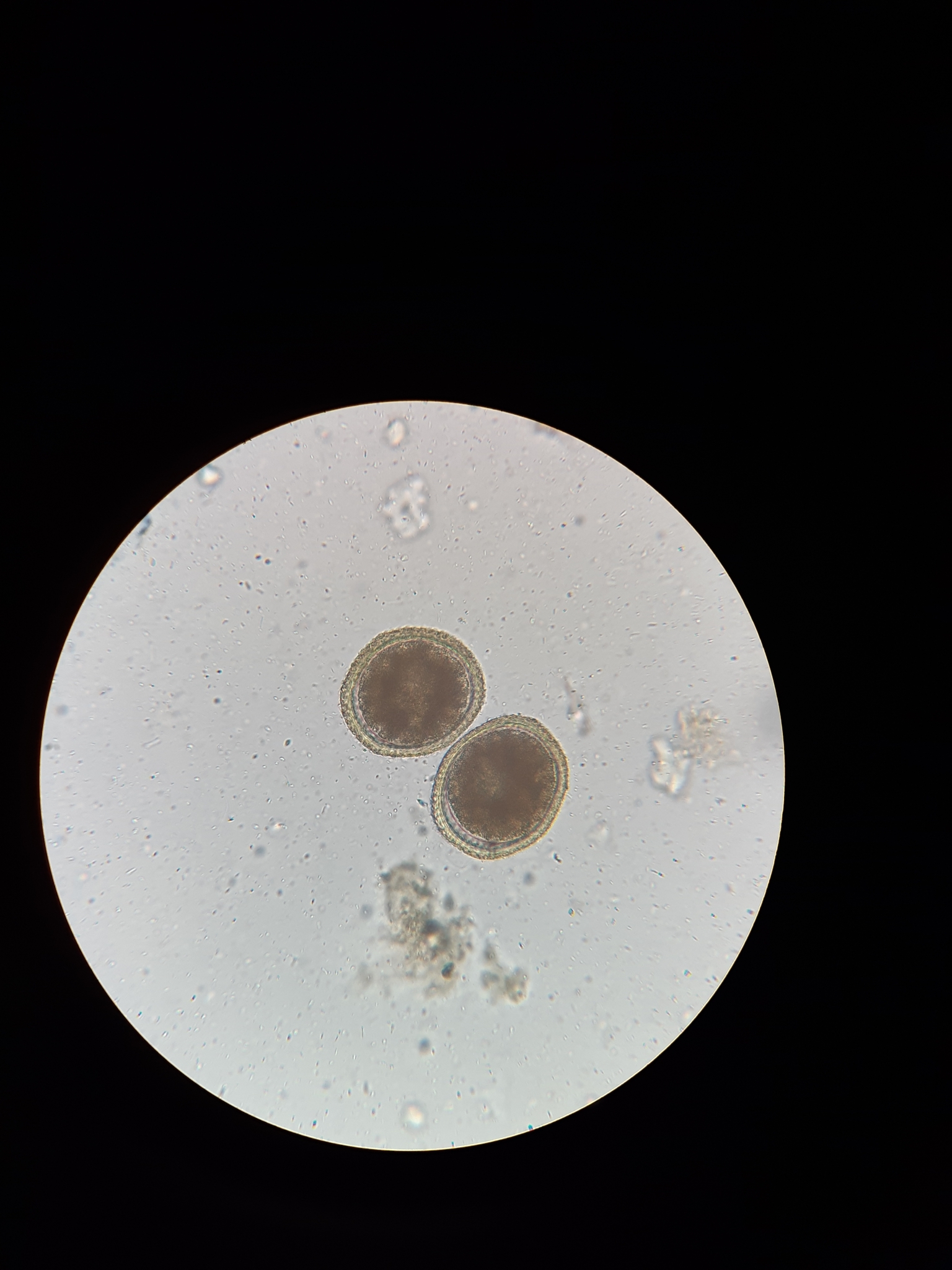 Toxocara canis (Werner, 1782) Stiles, 1905