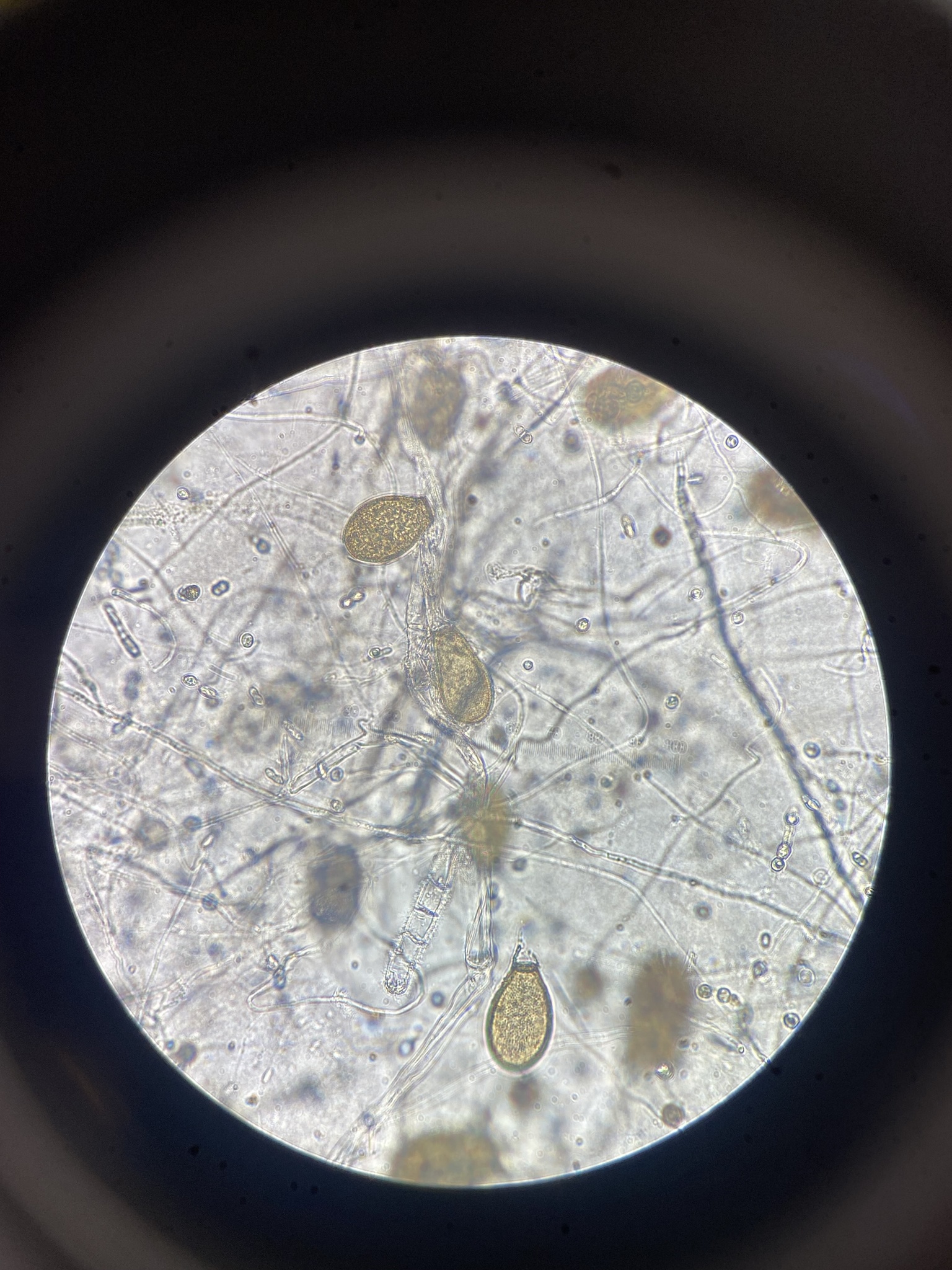 Blastocladiomycetes