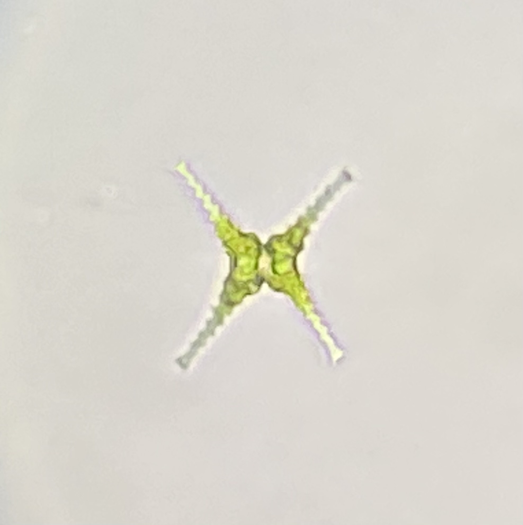 Staurastrum tetracerum Ralfs