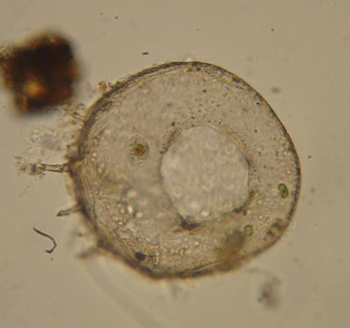 Centropyxis aculeata (Ehrenberg, 1832) Stein, 1859