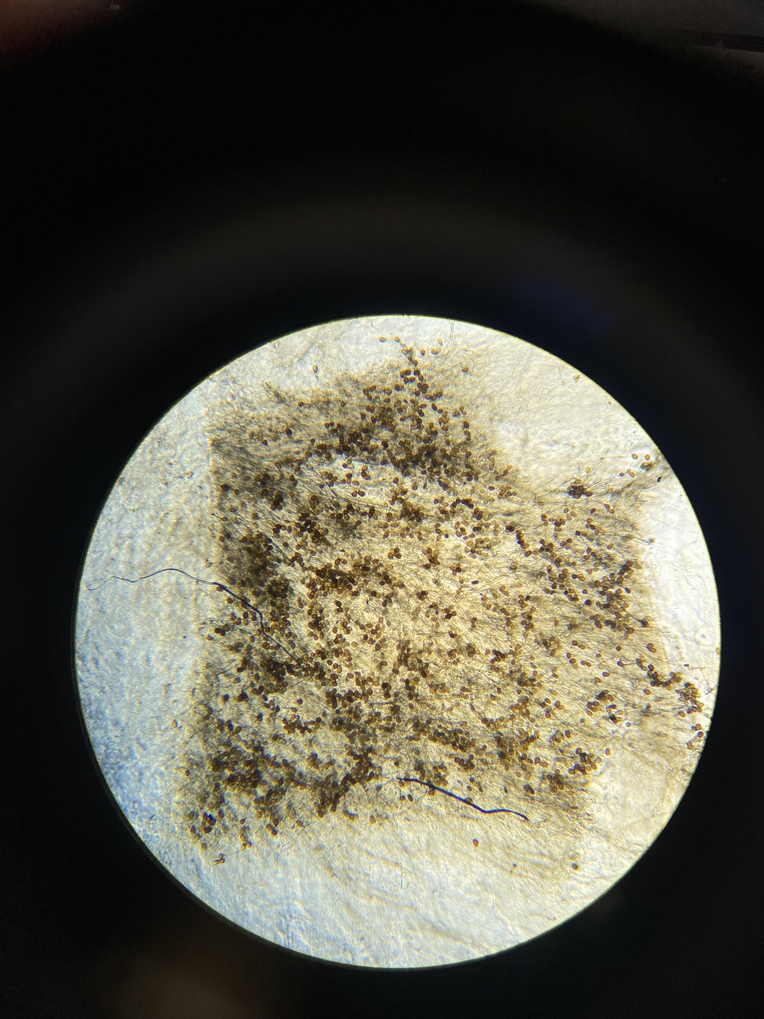 Blastocladiomycetes
