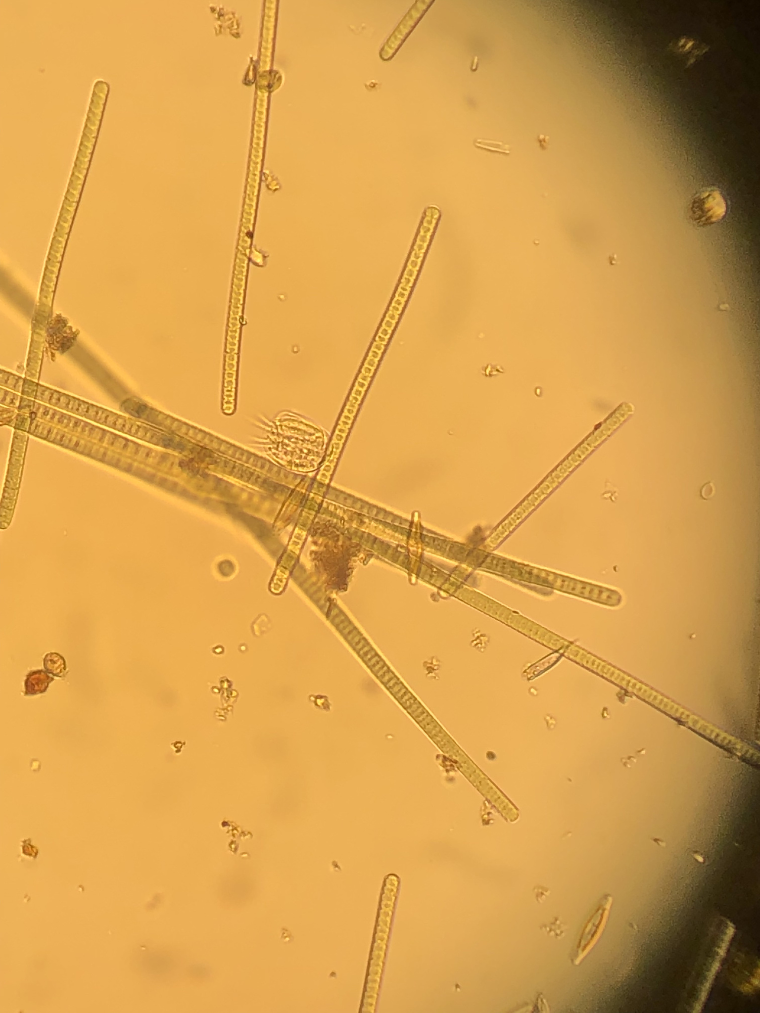 Aspidisca cicada (Müller, 1786) Claparède & Lachmann, 1858