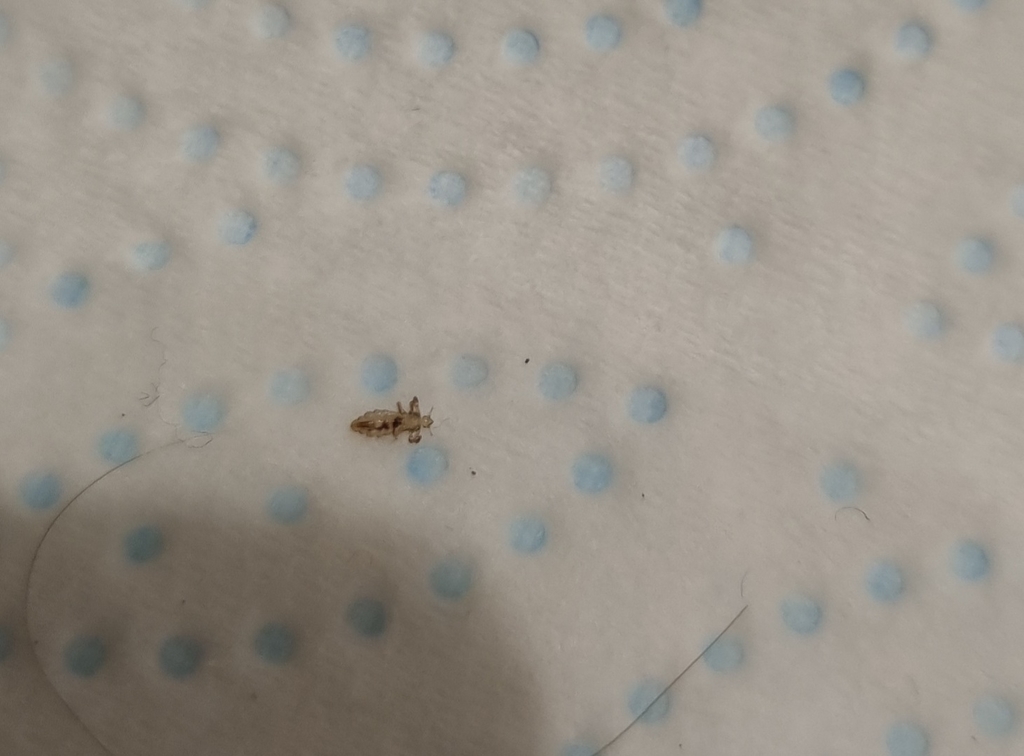 Human Louse from Esher on December 1, 2021 at 06:25 PM by Milo ...