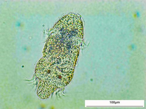 Didinium Under Microscope