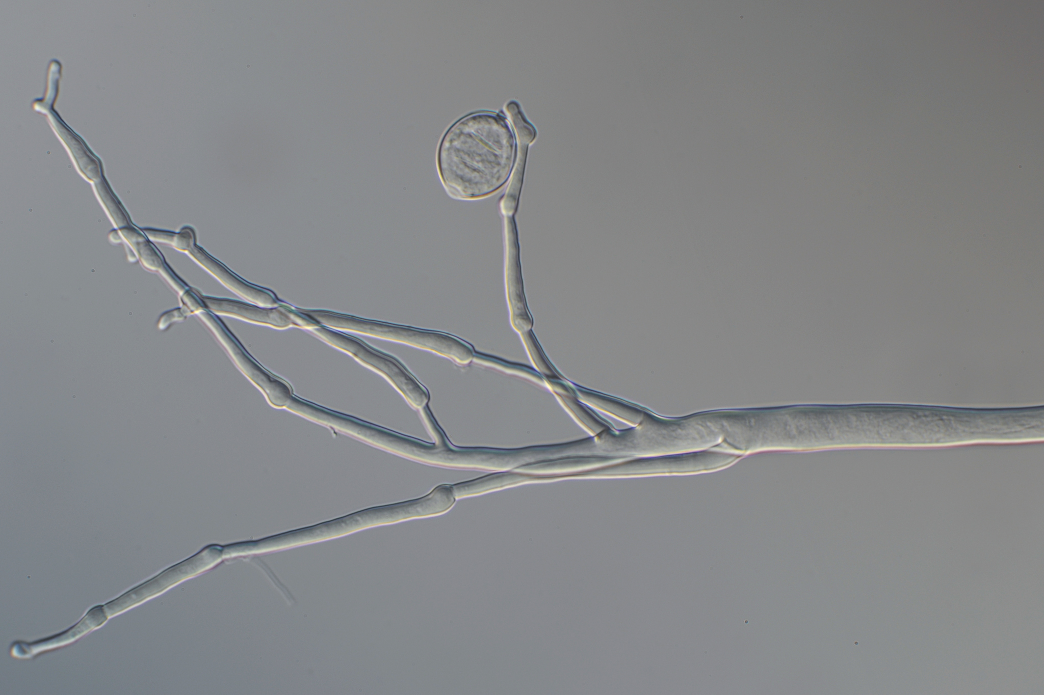 Phytophthora infestans (Mont.) de Bary
