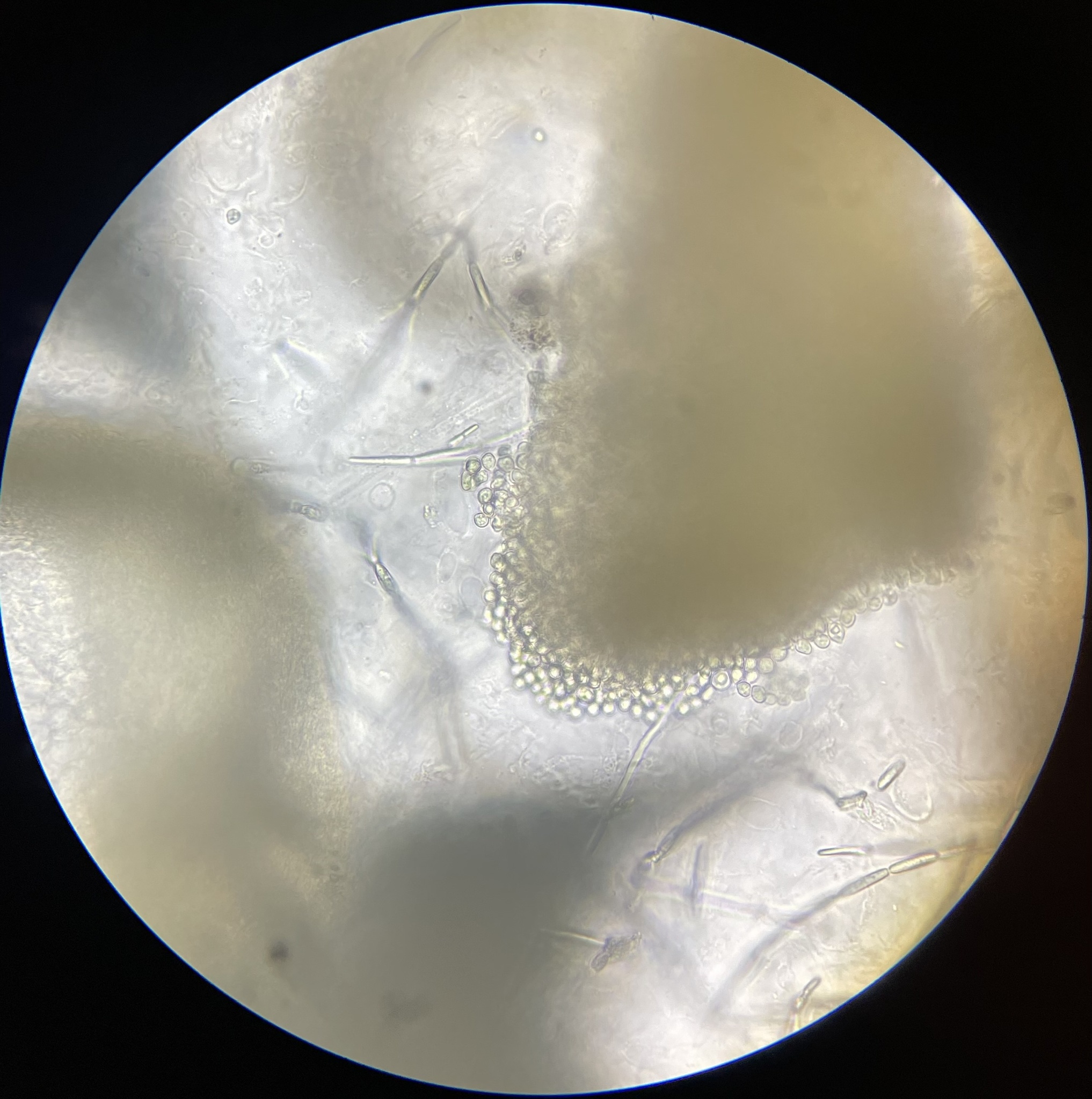 Tolypocladium W.Gams, 1971