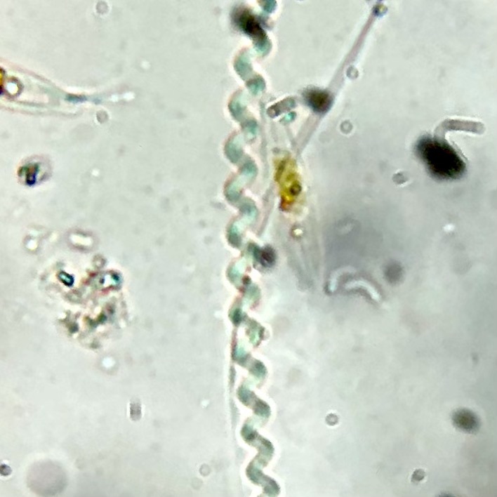 cyanobacteria from Salt / Pink Lake, Melbourne VIC, Australia on ...