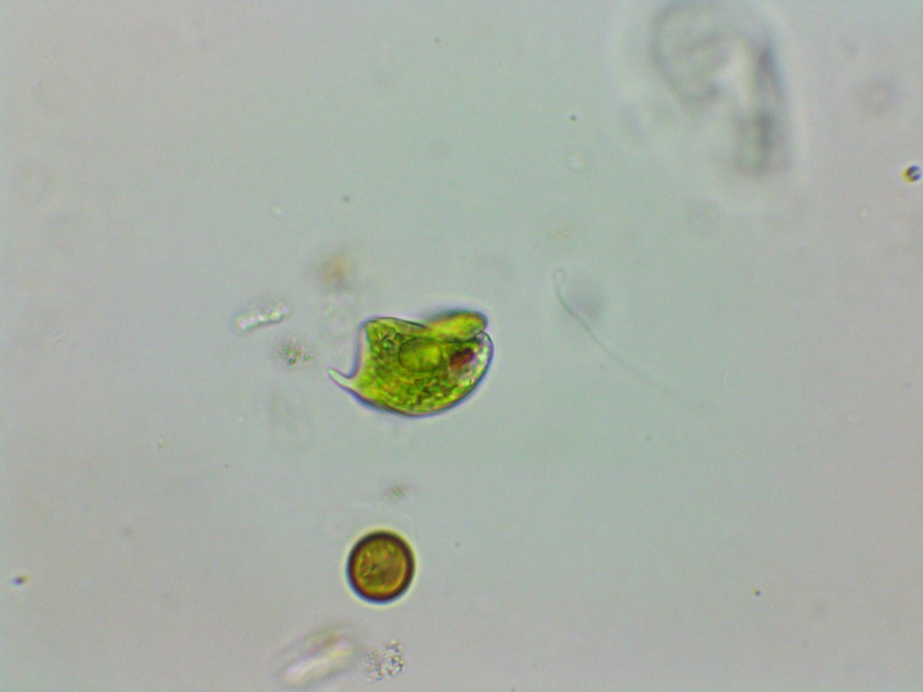 Phacus anomalus from Geelong VIC, Australia on January 25, 2022 at 12: ...