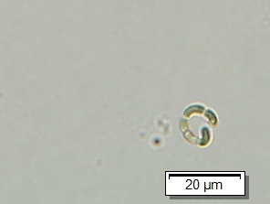 Stichococcus irregularis · iNaturalist