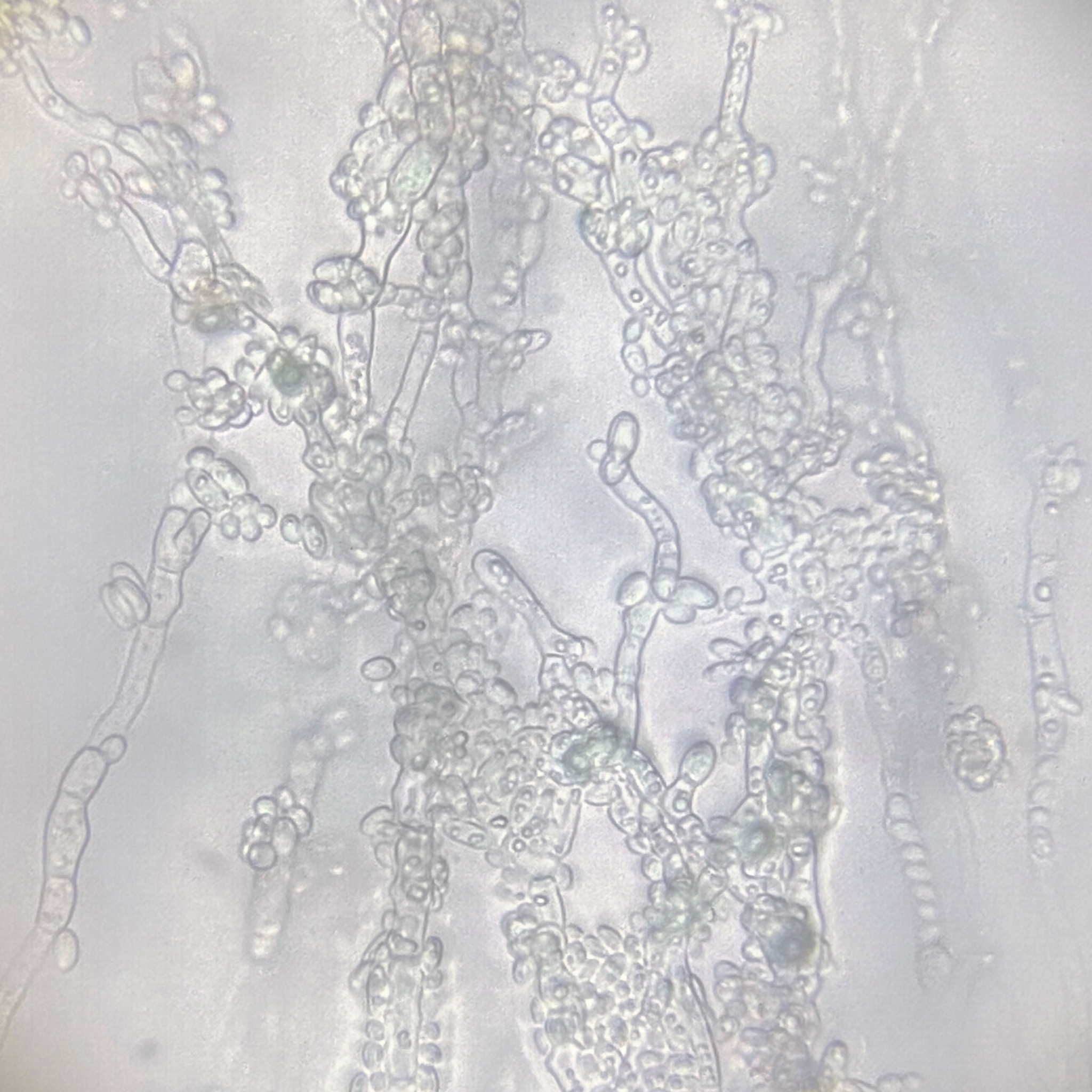 Aureobasidium pullulans (de Bary & Löwenthal) G.Arnaud
